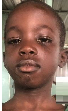 Orphan - Dead - 0381067 - International Charity Organization